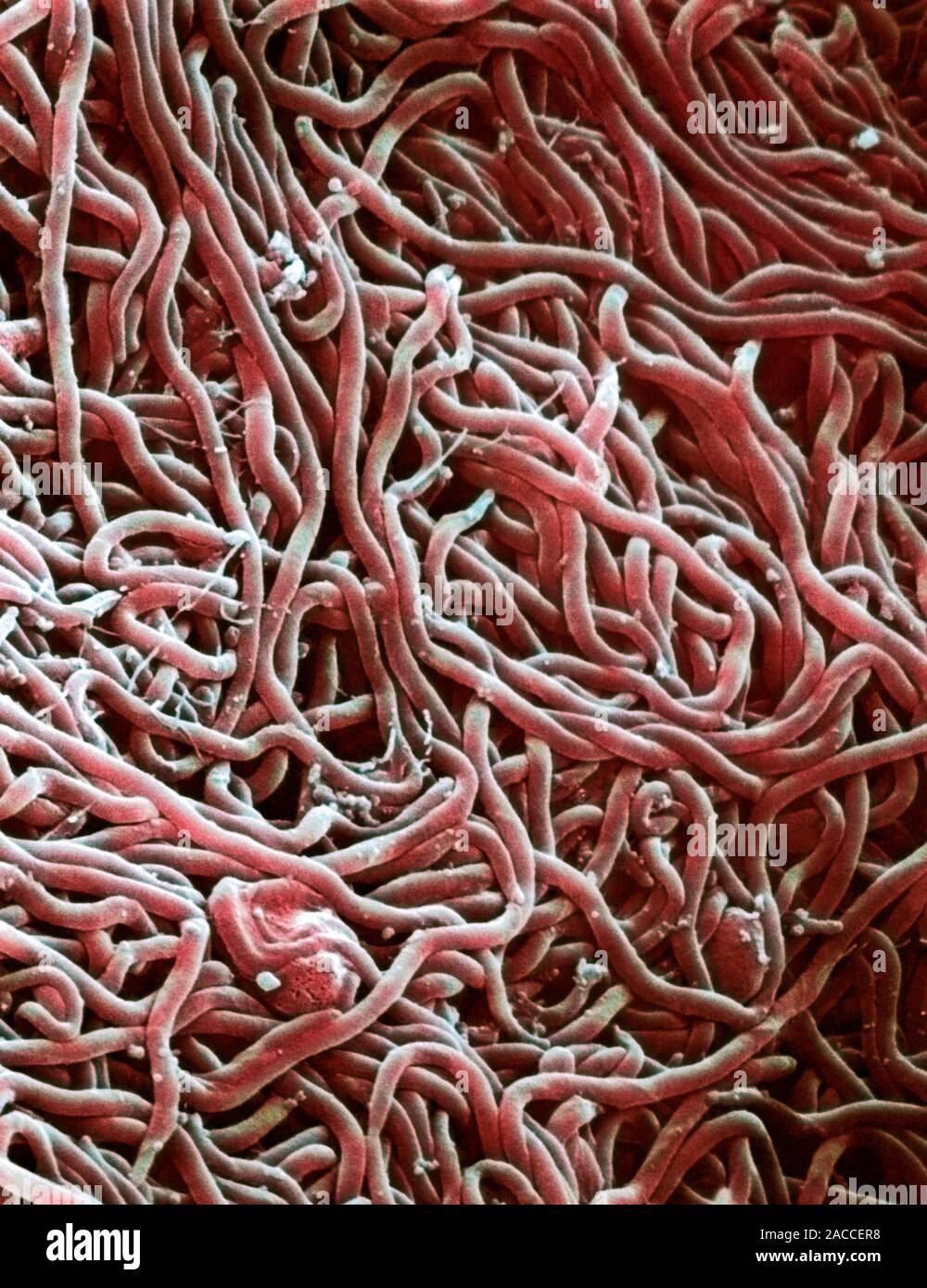 Borrelia bacteria, coloured scanning electron micrograph (SEM). These ...