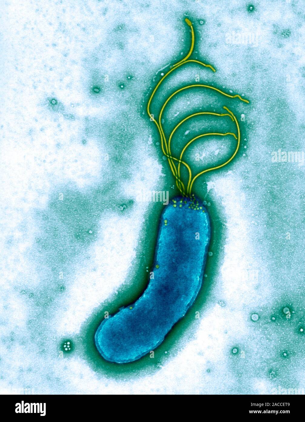 Helicobacter pylori bacterium, coloured transmission electron micrograph (TEM). This section ...