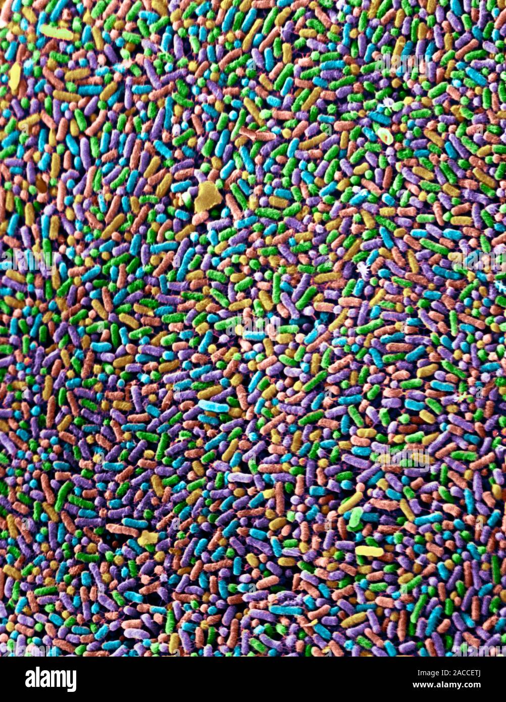 Salmonella bacteria, coloured scanning electron micrograph (SEM). Each ...