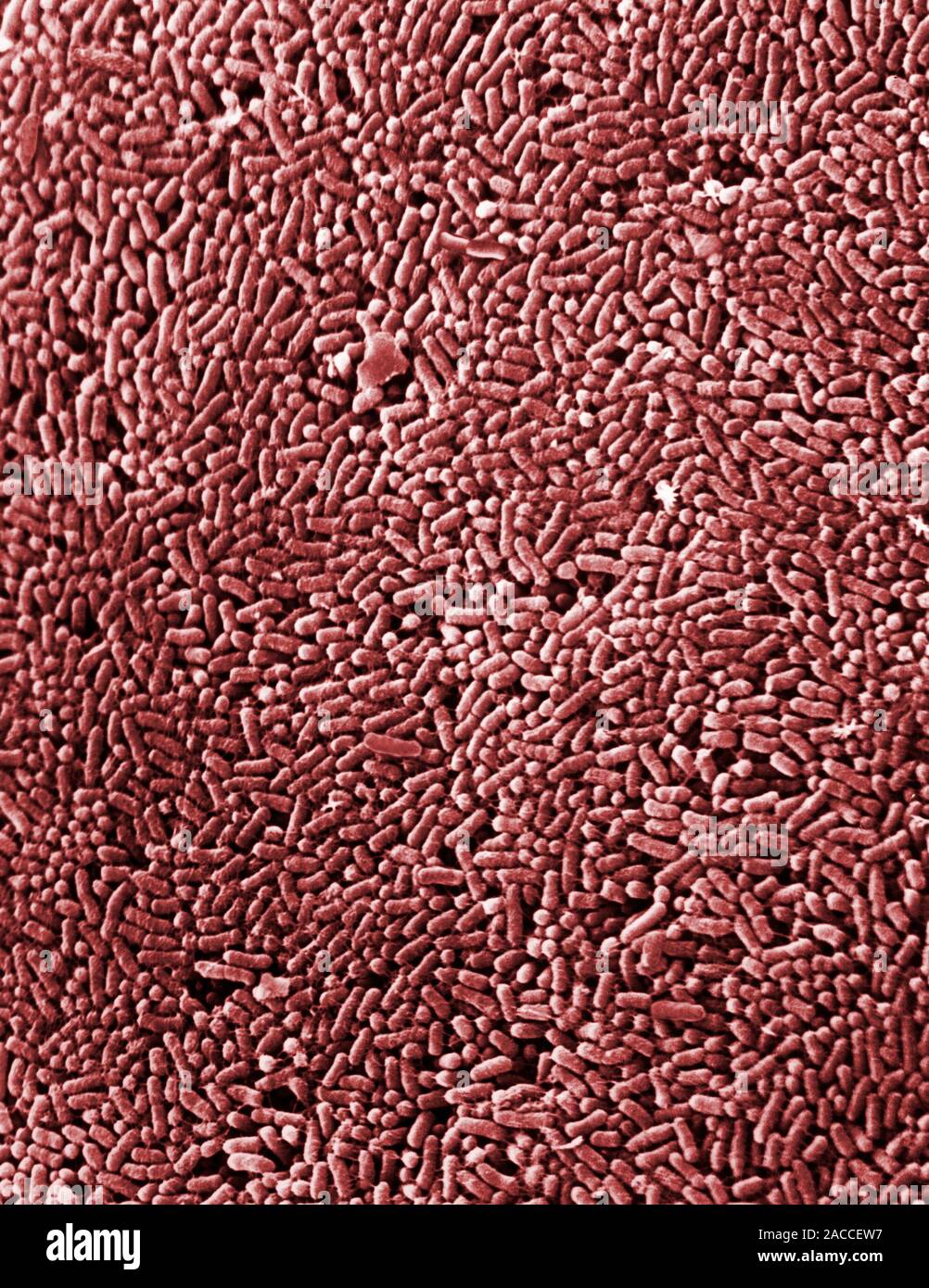 Salmonella bacteria, coloured scanning electron micrograph (SEM). Each ...
