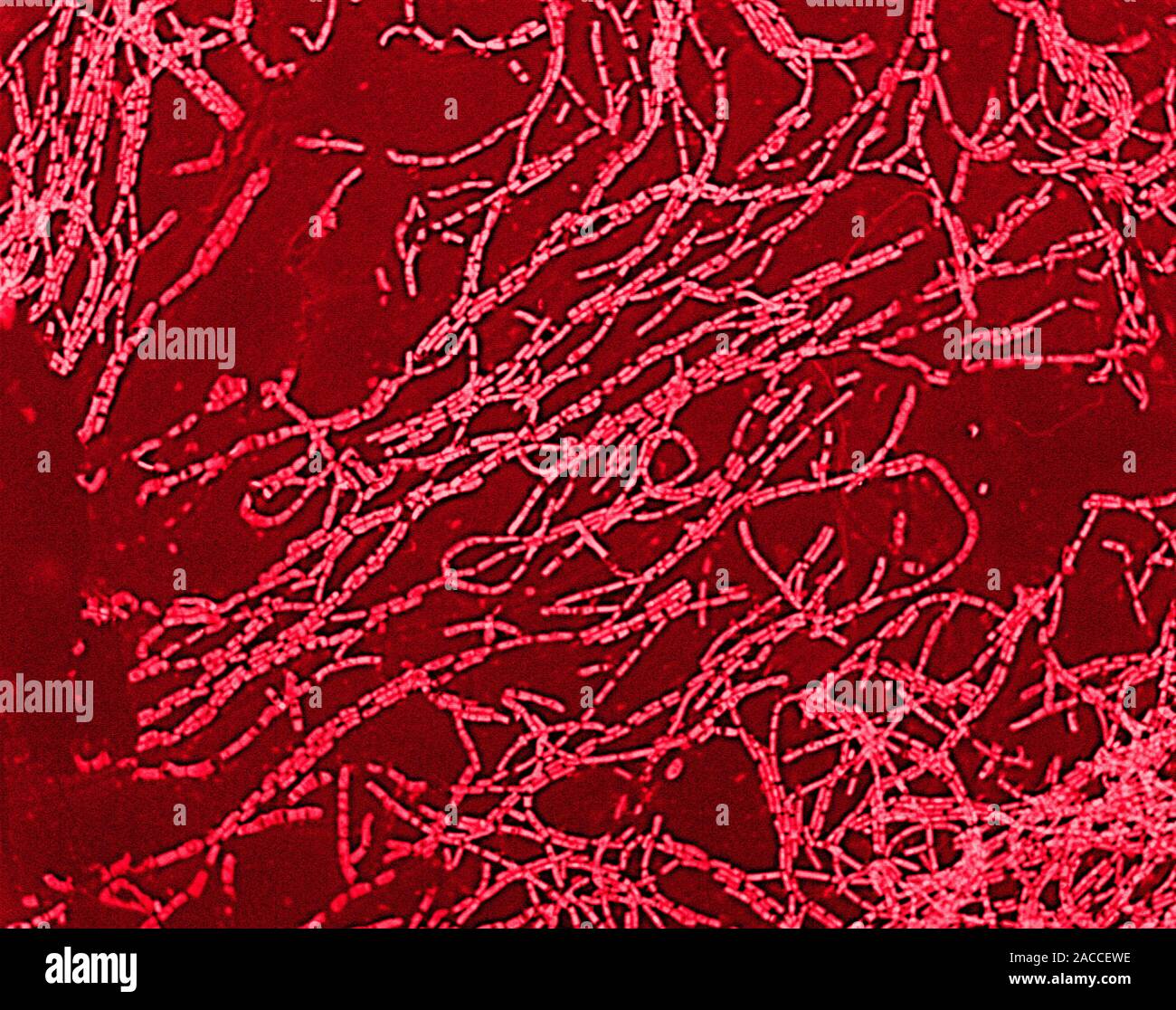 Anthrax bacteria. Light micrograph of anthrax bacteria (Bacillus ...