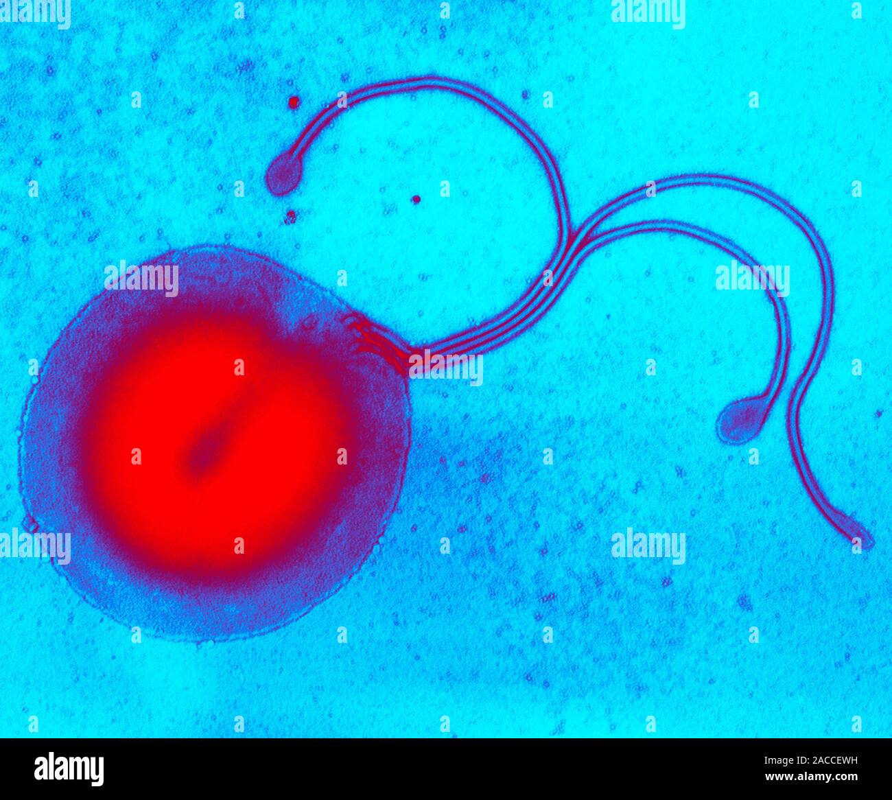 Helicobacter pylori bacterium, coloured transmission electron micrograph (TEM). This section ...