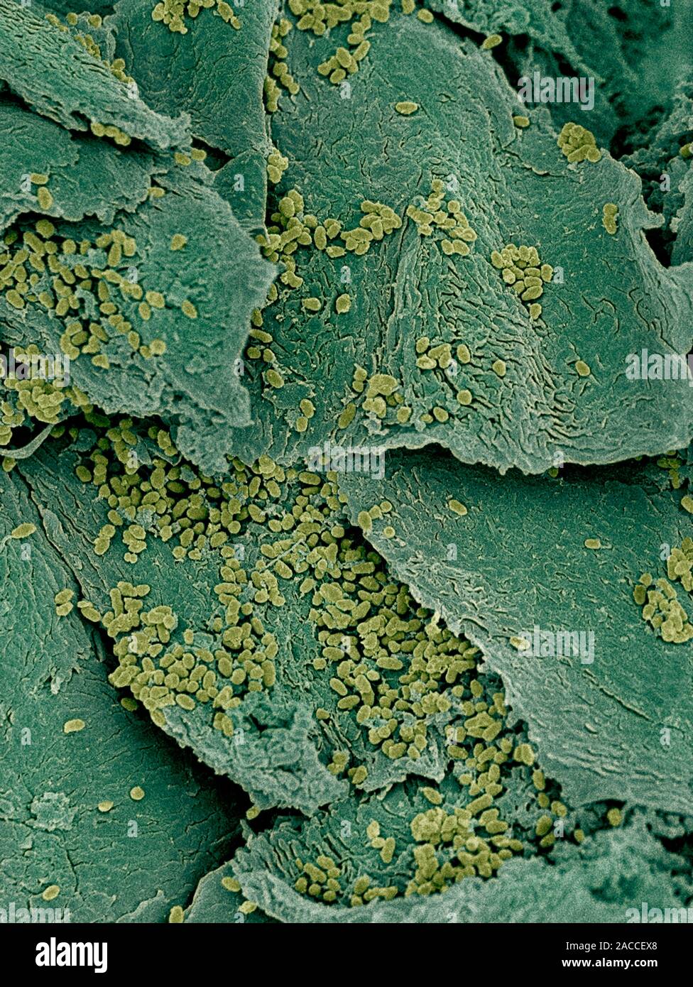 Bacteria on a nail. Coloured scanning electron micrograph (SEM) of a ...