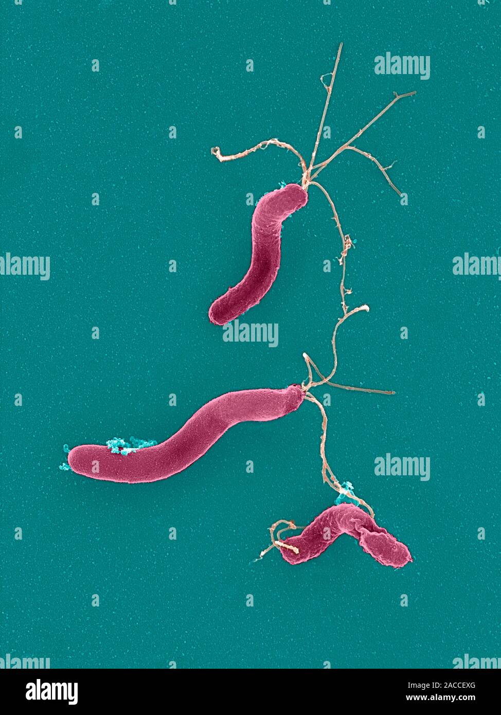 Helicobacter pylori bacteria. Coloured scanning electron micrograph (SEM) of three Helicobacter ...