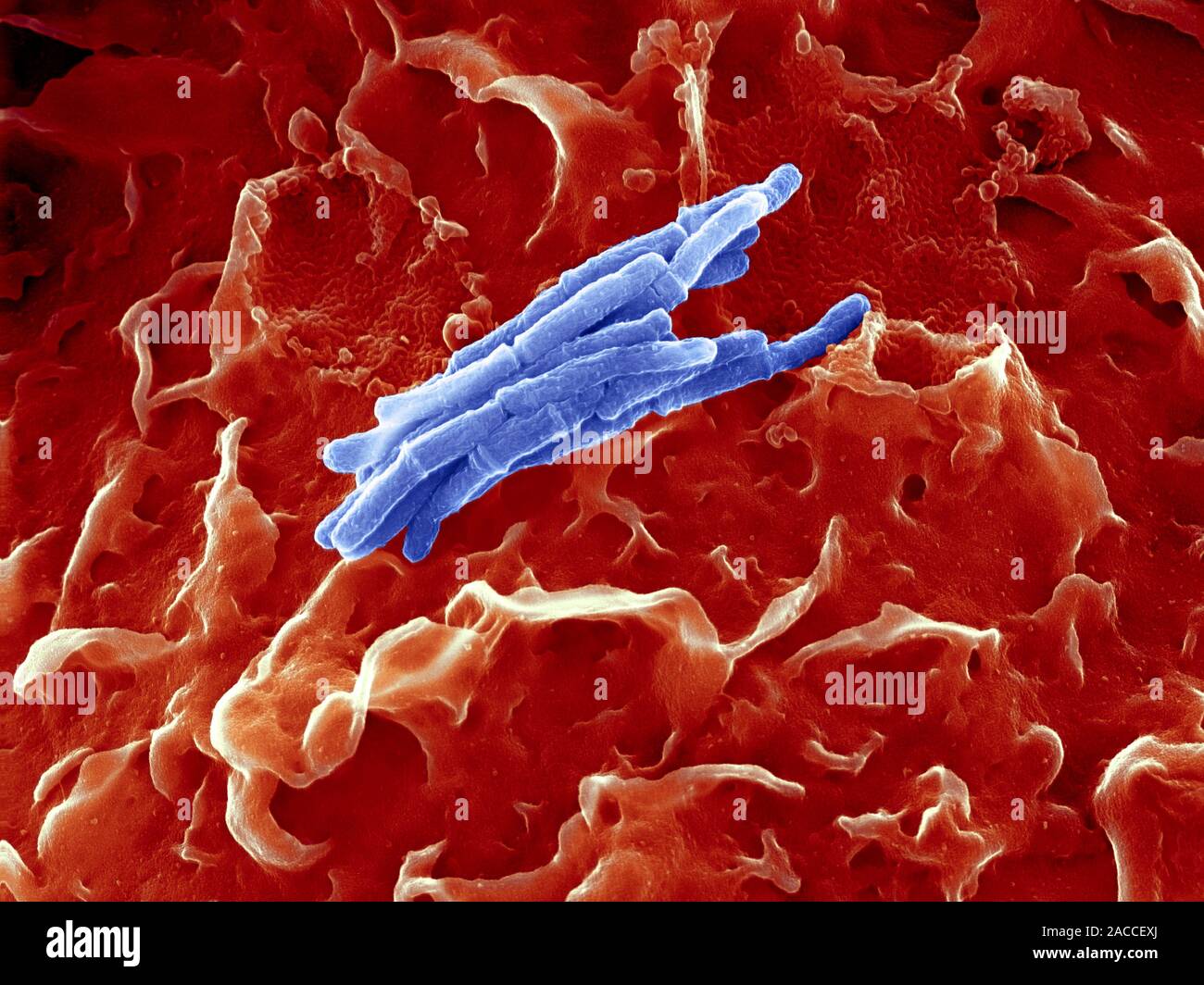 Bacteria infecting a macrophage. Coloured scanning electron micrograph (SEM) of Mycobacterium ...