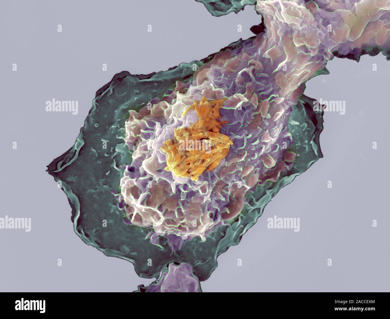 Bacteria infecting a macrophage. Coloured scanning electron micrograph (SEM) of Mycobacterium ...