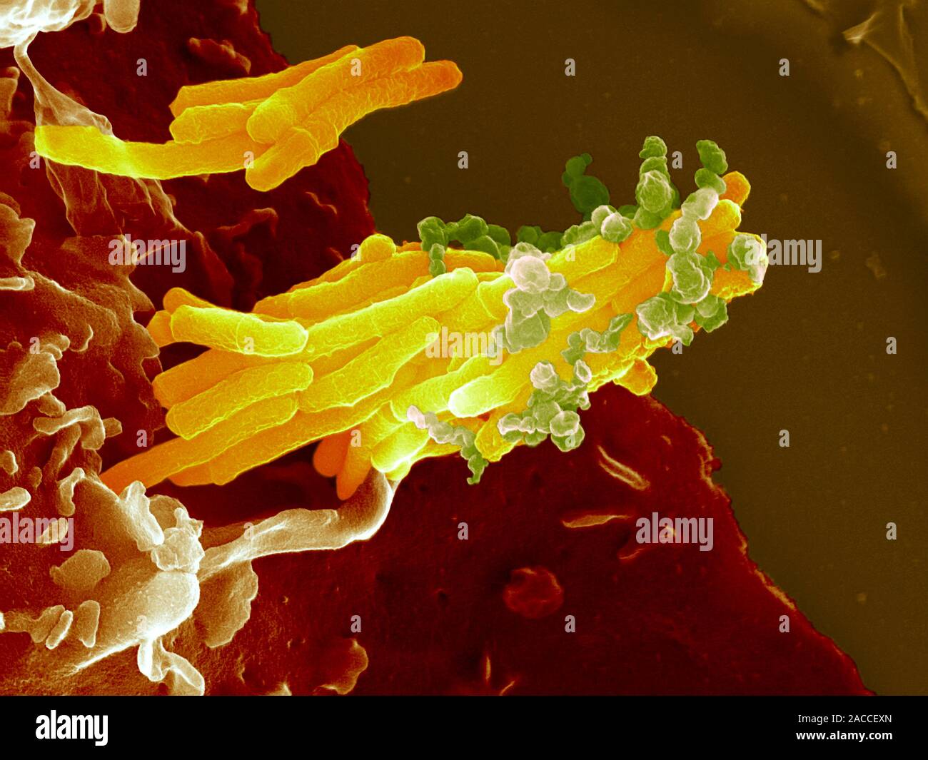 Bacteria infecting a macrophage. Coloured scanning electron micrograph (SEM) of Mycobacterium ...