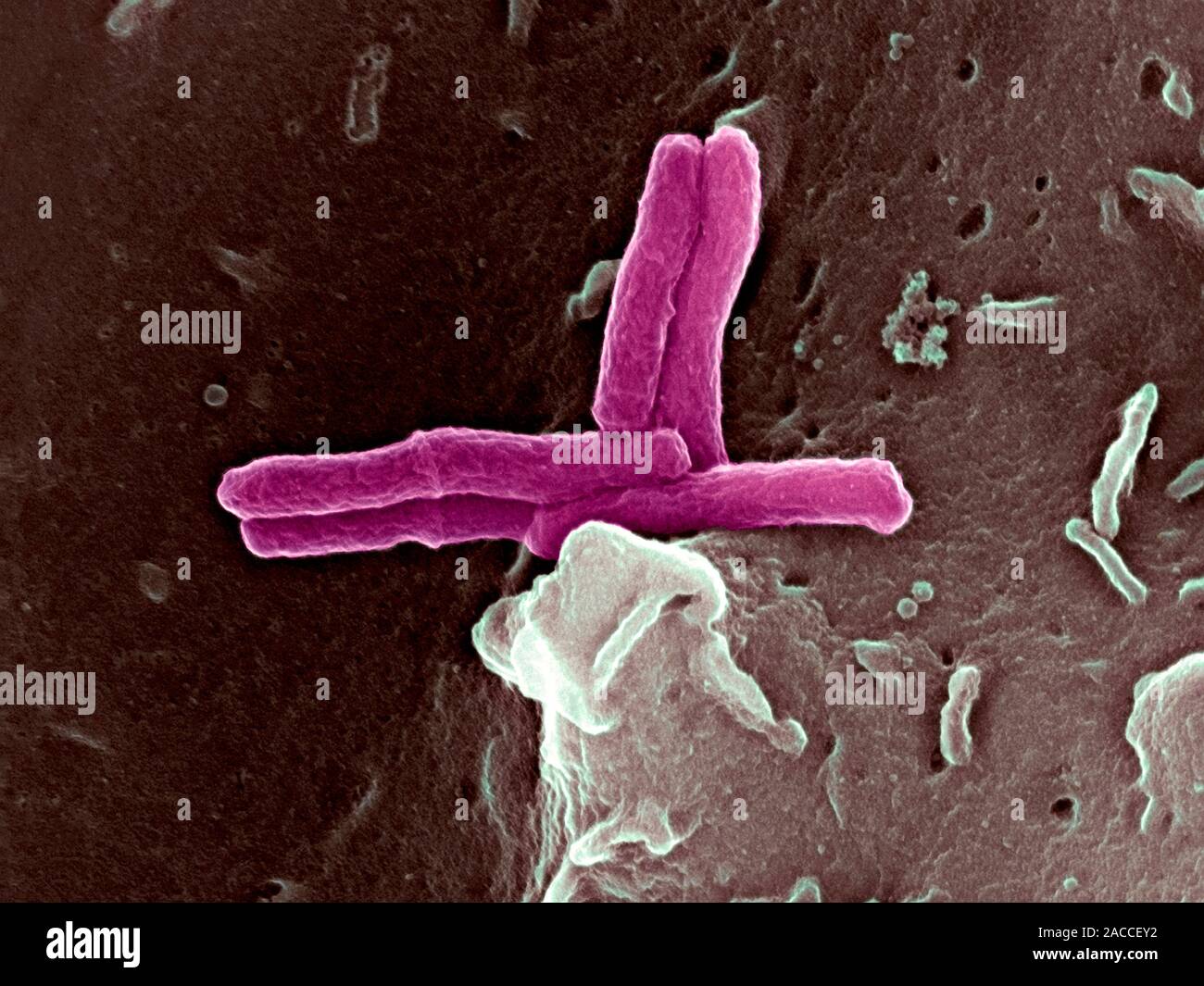 Bacteria infecting a macrophage. Coloured scanning electron micrograph (SEM) of Mycobacterium ...