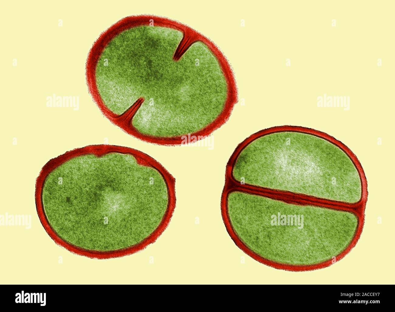 Staphylococcus Aureus Bacteria Dividing Coloured Transmission Electron Micrograph At Lower