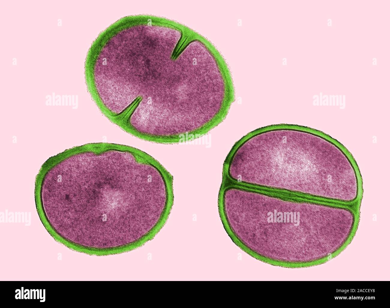 Staphylococcus Aureus Bacteria Dividing Coloured Transmission Electron Micrograph At Lower