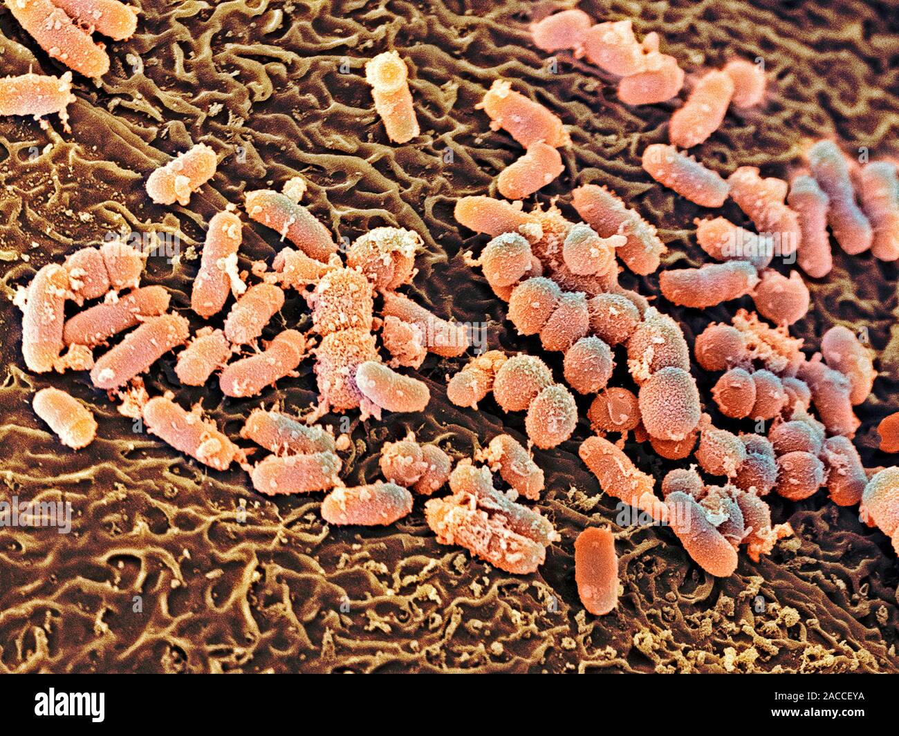 Bacteria in the nose. Coloured scanning electron micrograph (SEM) of ...