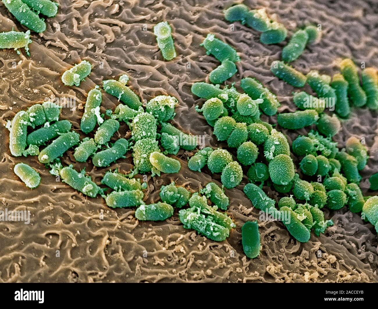 Bacteria In The Nose Coloured Scanning Electron Micrograph Sem Of Bacteria Green On The