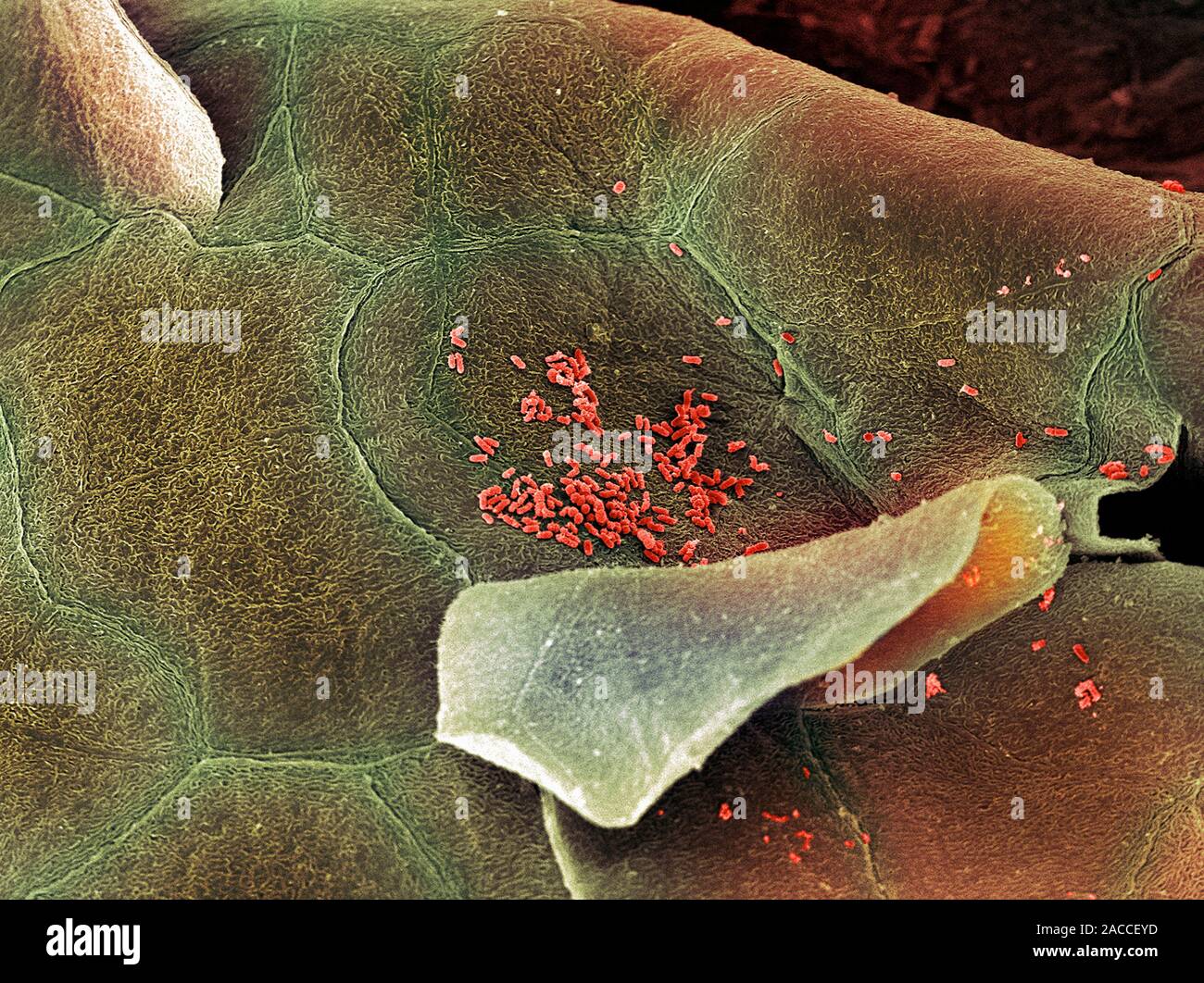 Bacteria in the nose. Coloured scanning electron micrograph (SEM) of ...