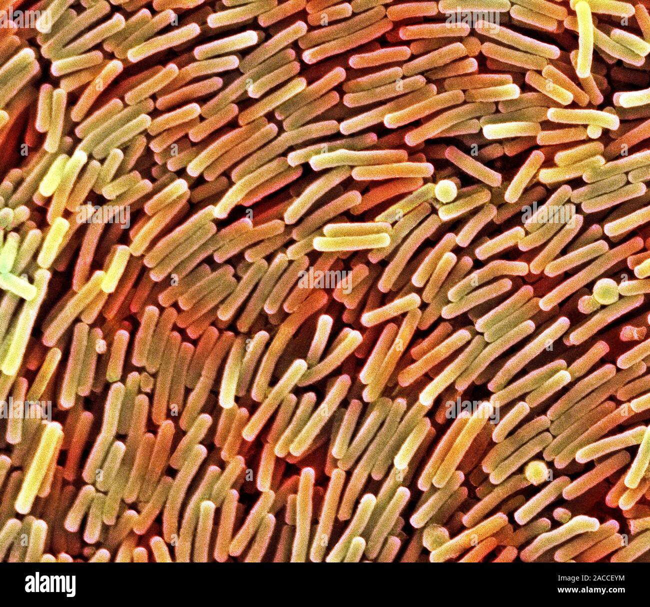 Clostridium Difficile Bacteria Coloured Scanning Electron Micrograph Sem These Rod Shaped
