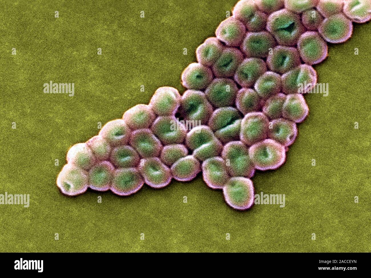 Acinetobacter baumannii bacteria, coloured scanning electron micrograph ...