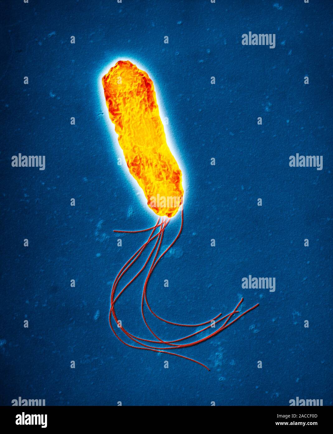 Burkholderia pseudomallei bacterium, coloured transmission electron ...