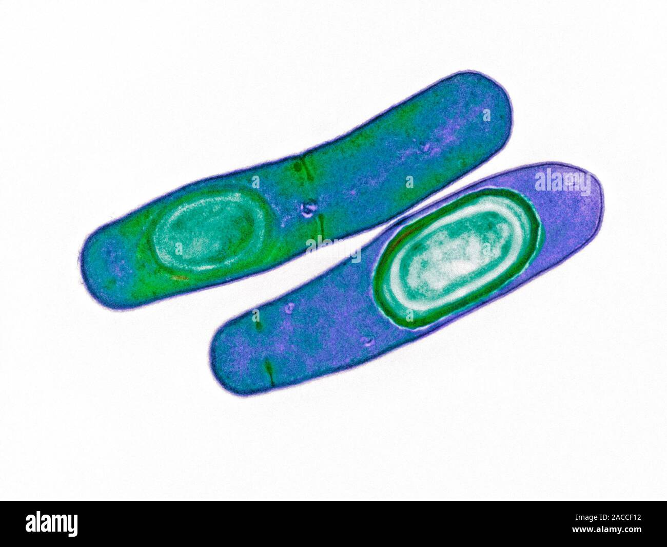 Clostridium difficile drug-resistant bacteria, coloured transmission ...