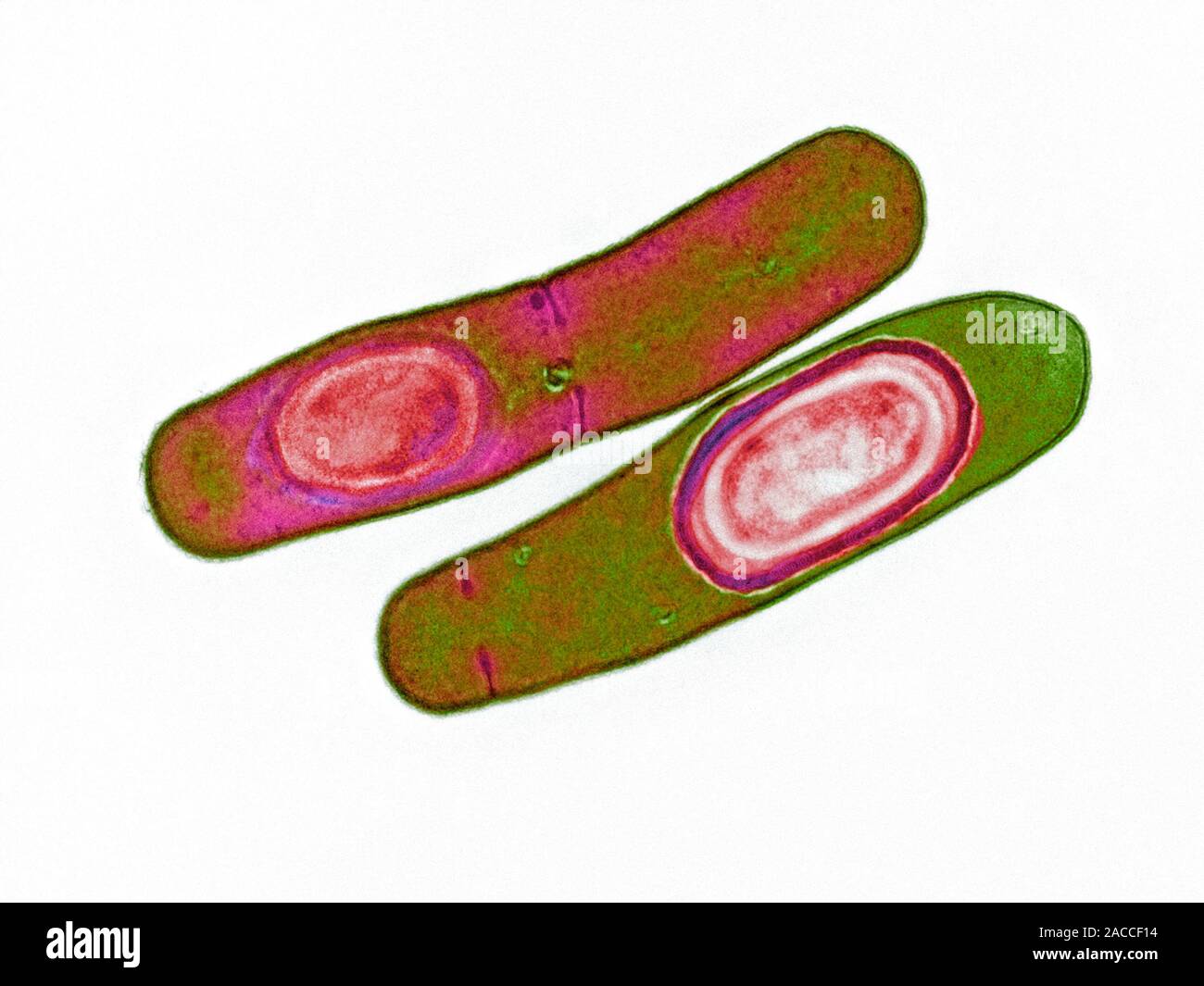 Clostridium difficile drug-resistant bacteria, coloured transmission ...