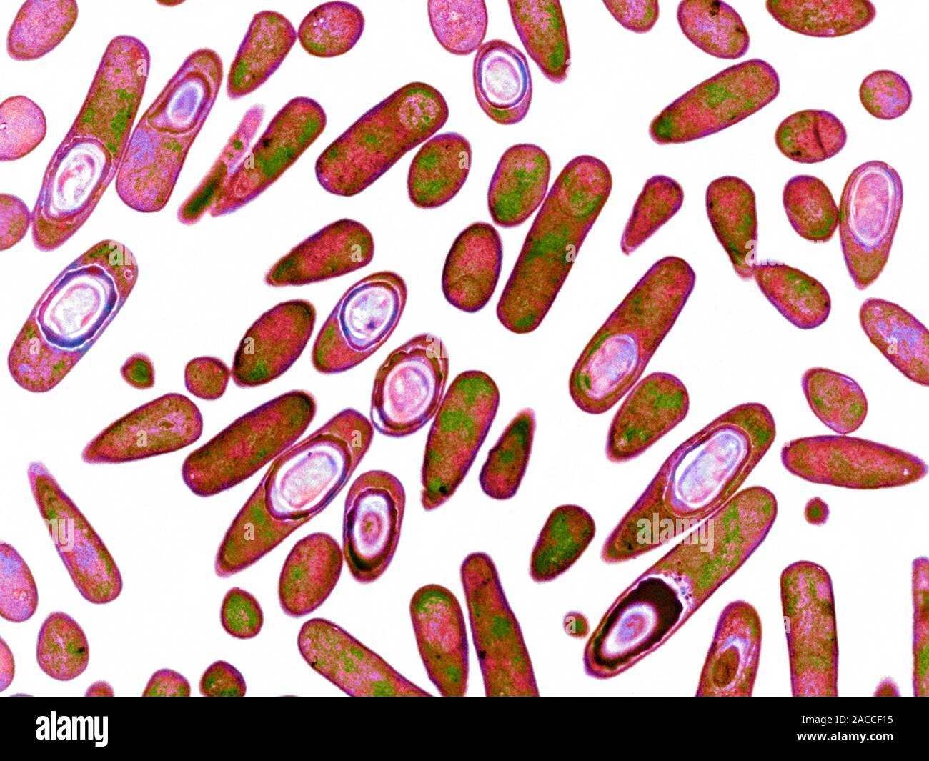 Clostridium difficile drug-resistant bacteria, coloured transmission ...