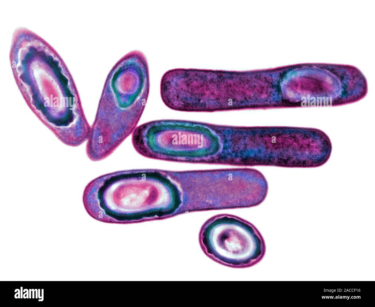 Clostridium difficile drug-resistant bacteria, coloured transmission ...