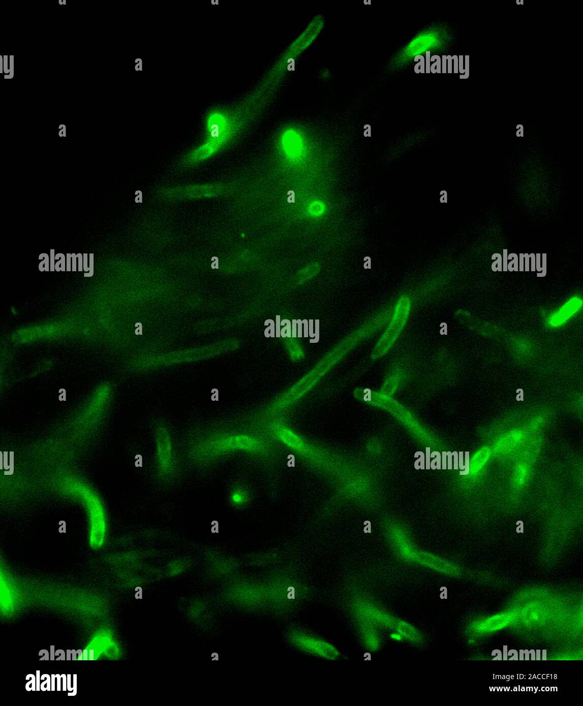 Anthrax bacteria. Fluorescent light micrograph of Bacillus anthracis ...