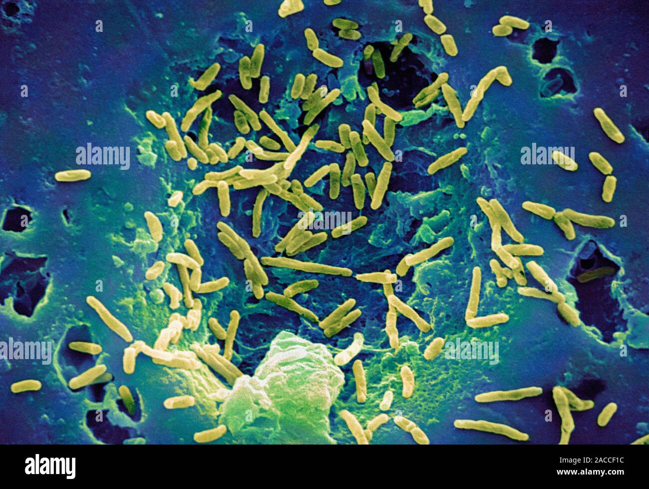 Mycobacterium chelonae bacteria, coloured scanning electron micrograph ...
