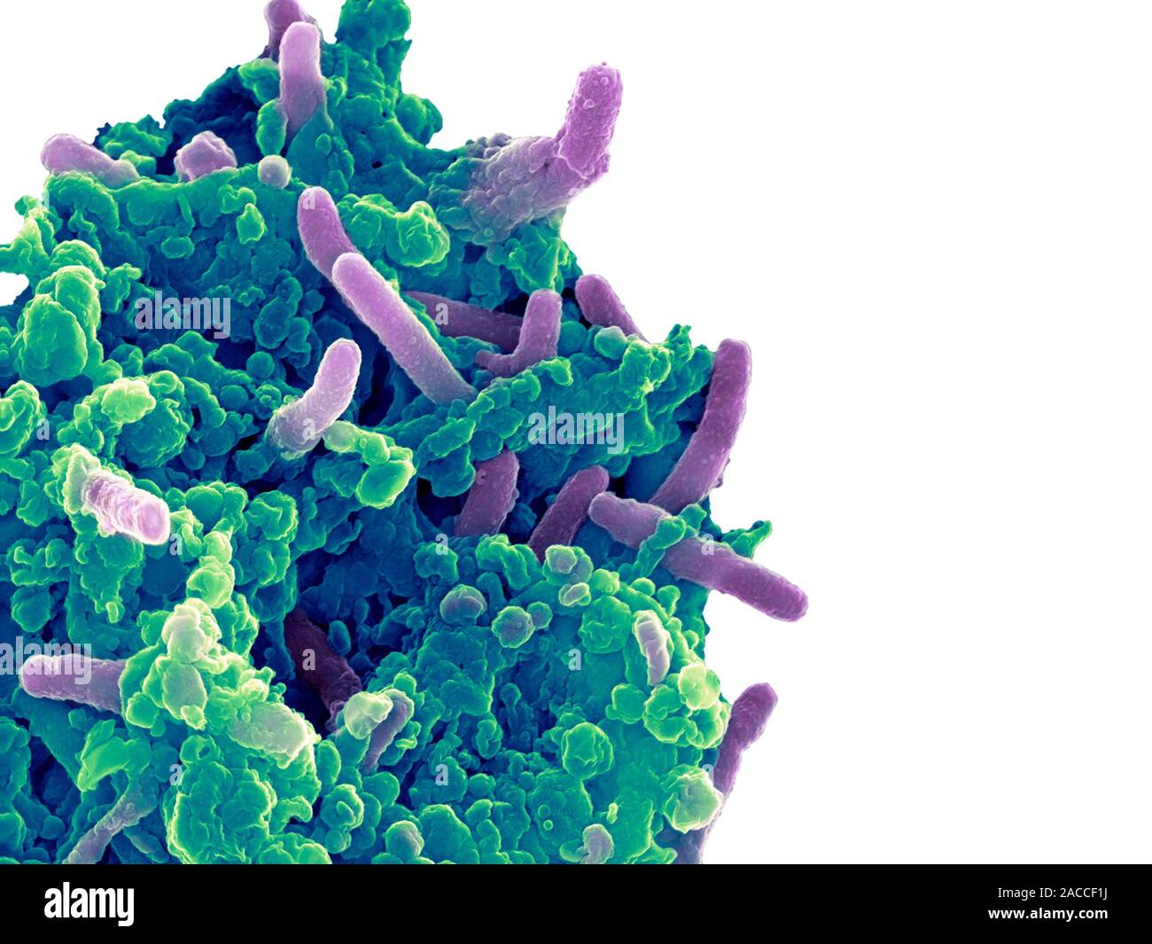 Bacteria infecting a macrophage. Coloured scanning electron micrograph (SEM) of Mycobacterium ...