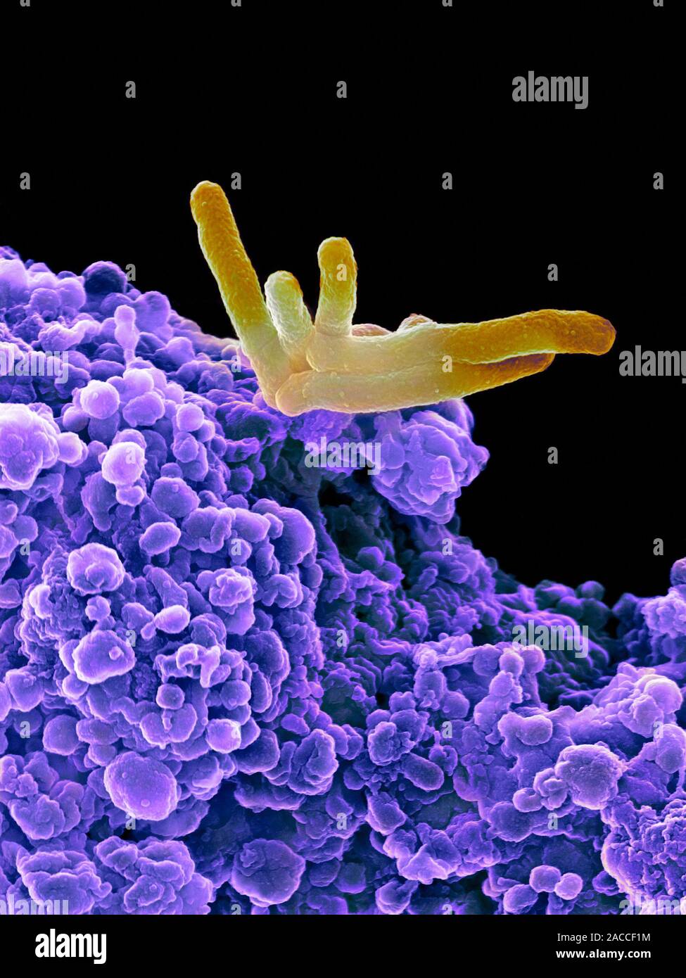 Bacteria infecting a macrophage. Coloured scanning electron micrograph (SEM) of Mycobacterium ...