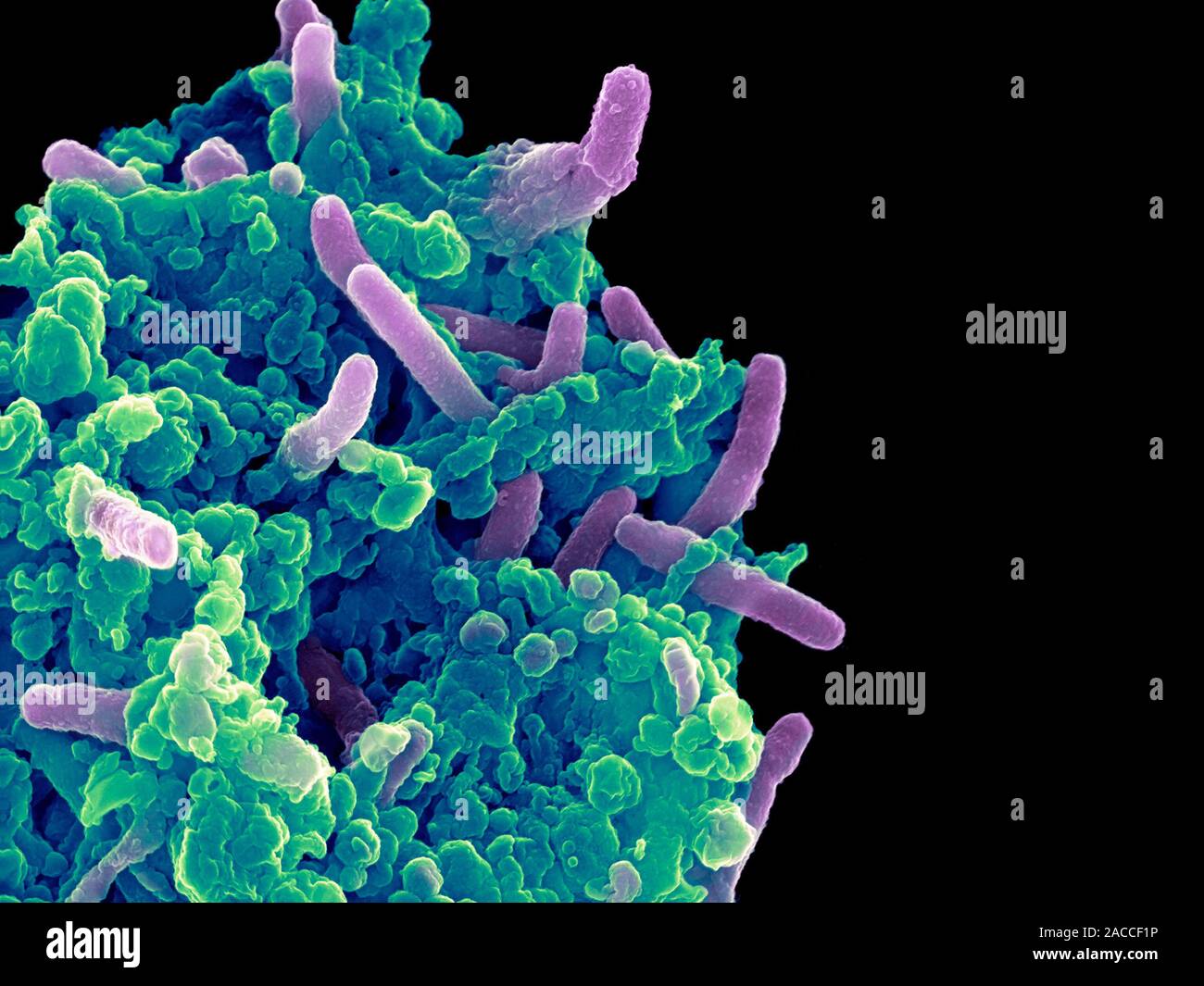 Bacteria infecting a macrophage. Coloured scanning electron micrograph (SEM) of Mycobacterium ...