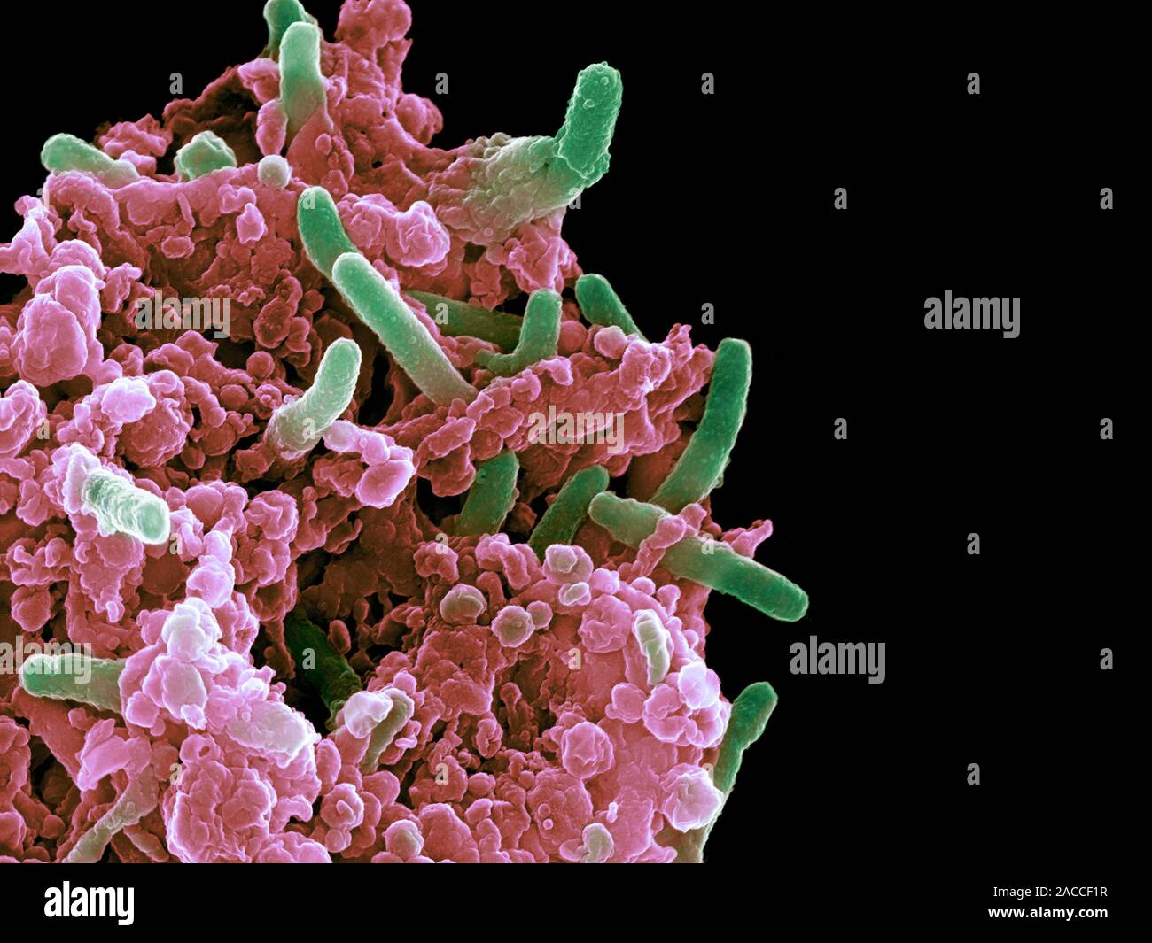 Bacteria infecting a macrophage. Coloured scanning electron micrograph ...