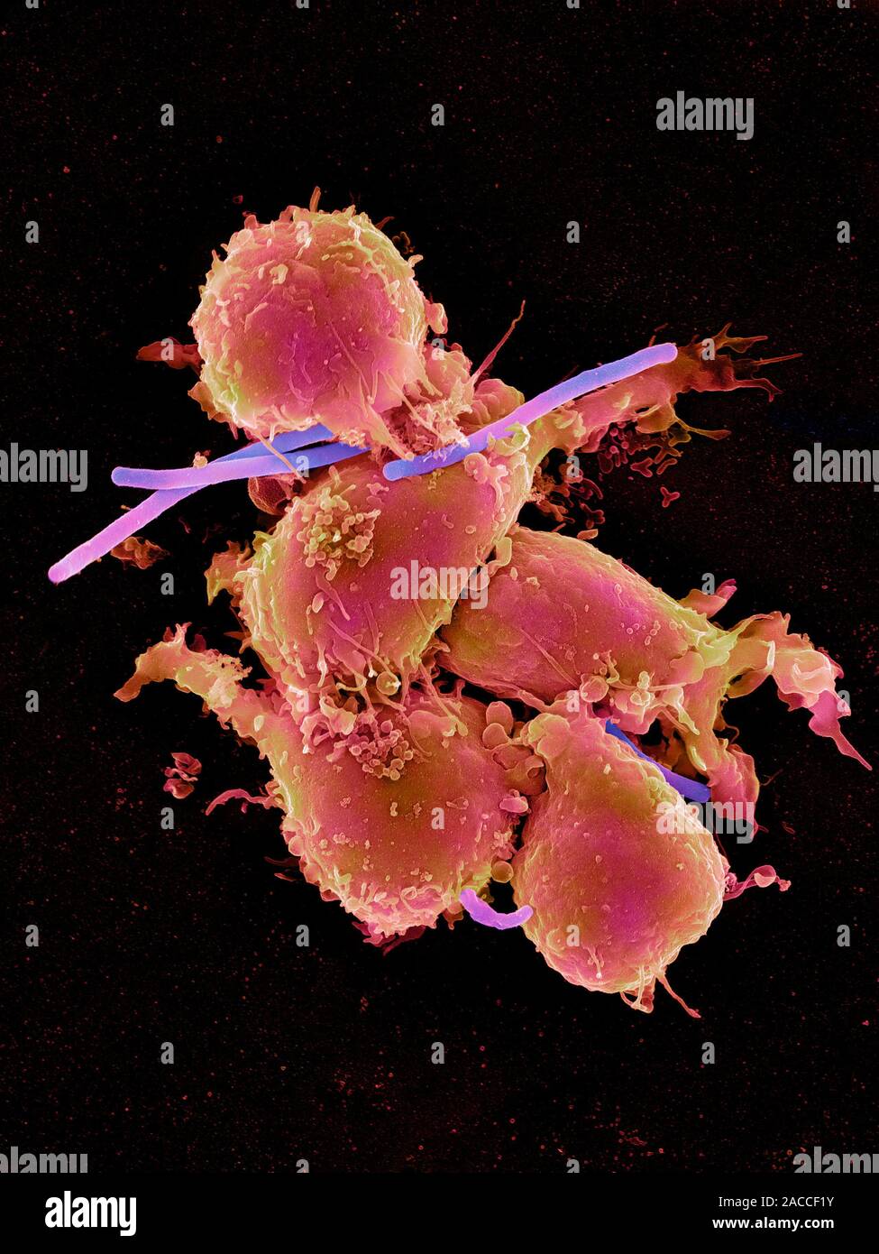 Bacteria infecting macrophage cells. Coloured scanning electron micrograph (SEM) of Bacillus ...