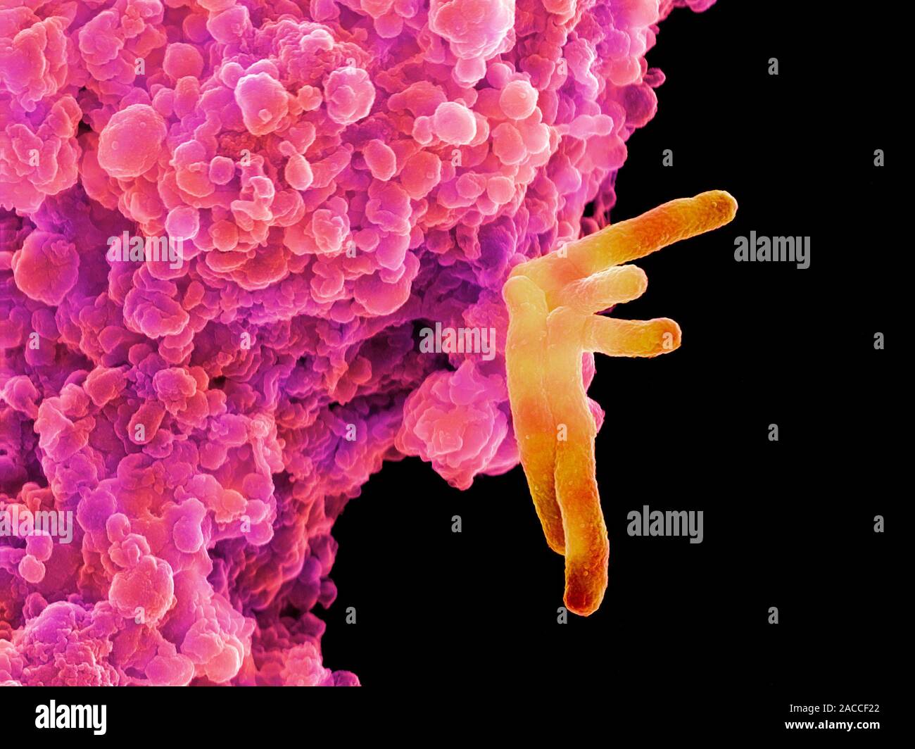 Bacteria infecting a macrophage. Coloured scanning electron micrograph (SEM) of Mycobacterium ...