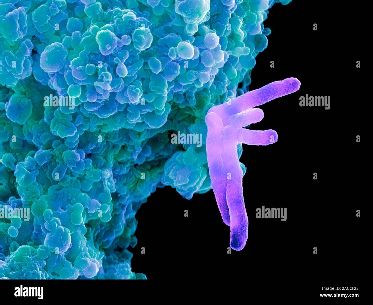 Bacteria infecting a macrophage. Coloured scanning electron micrograph (SEM) of Mycobacterium ...
