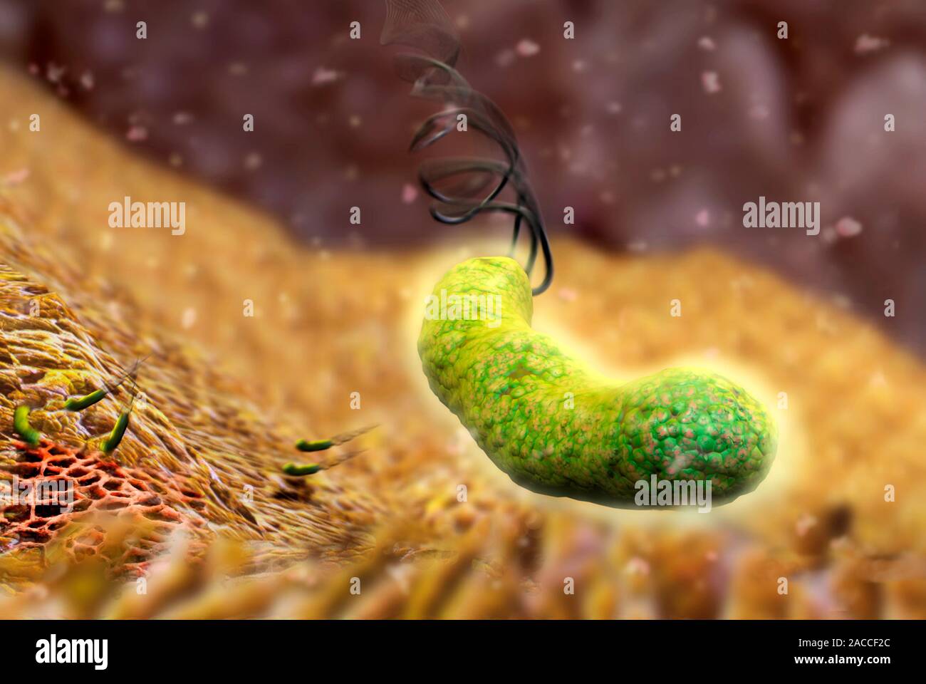 Helicobacter pylori bacteria. Computer artwork of Helicobacter pylori bacteria in a human ...