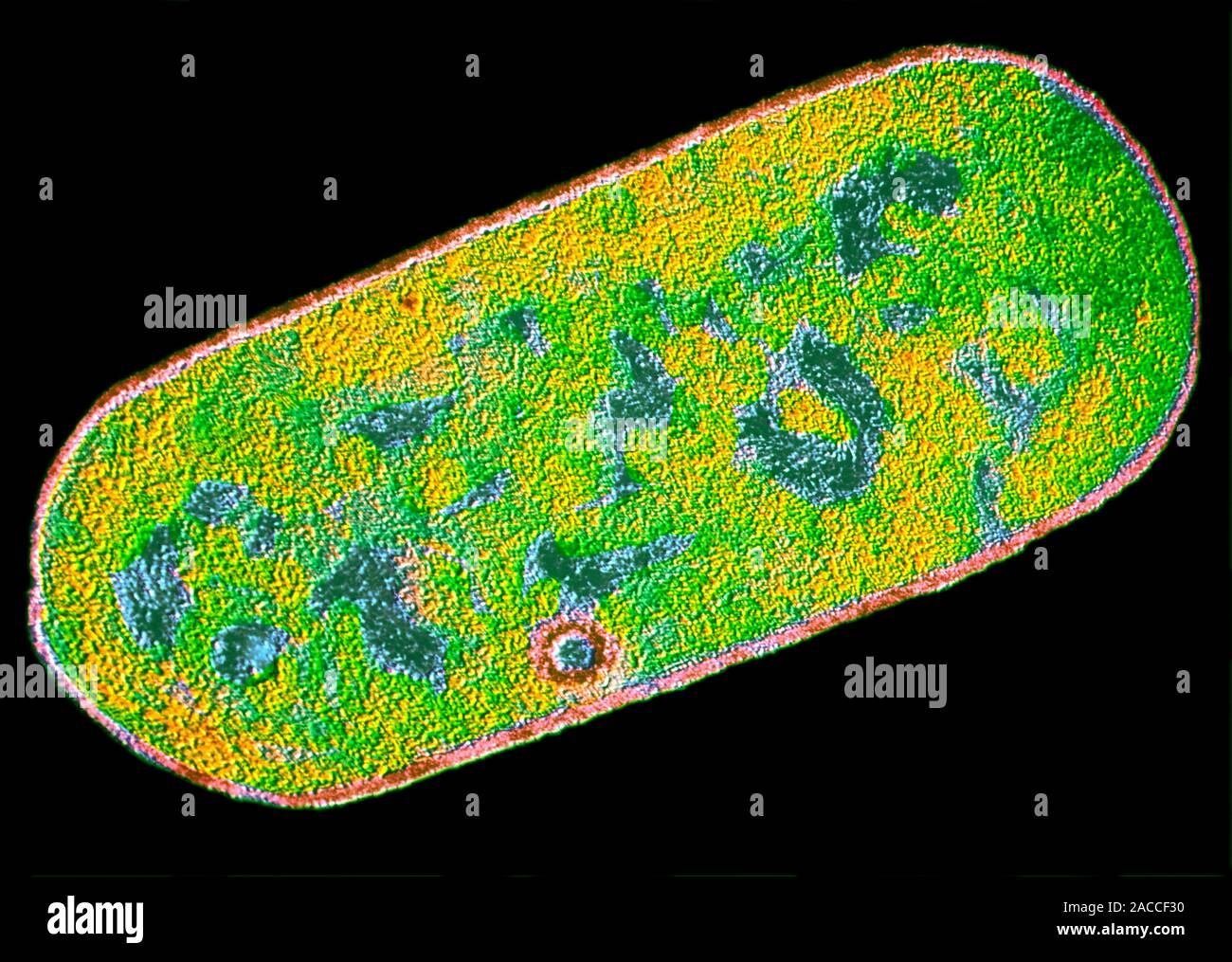 Clostridium perfringens bacterium, coloured TEM. This bacterium, also ...