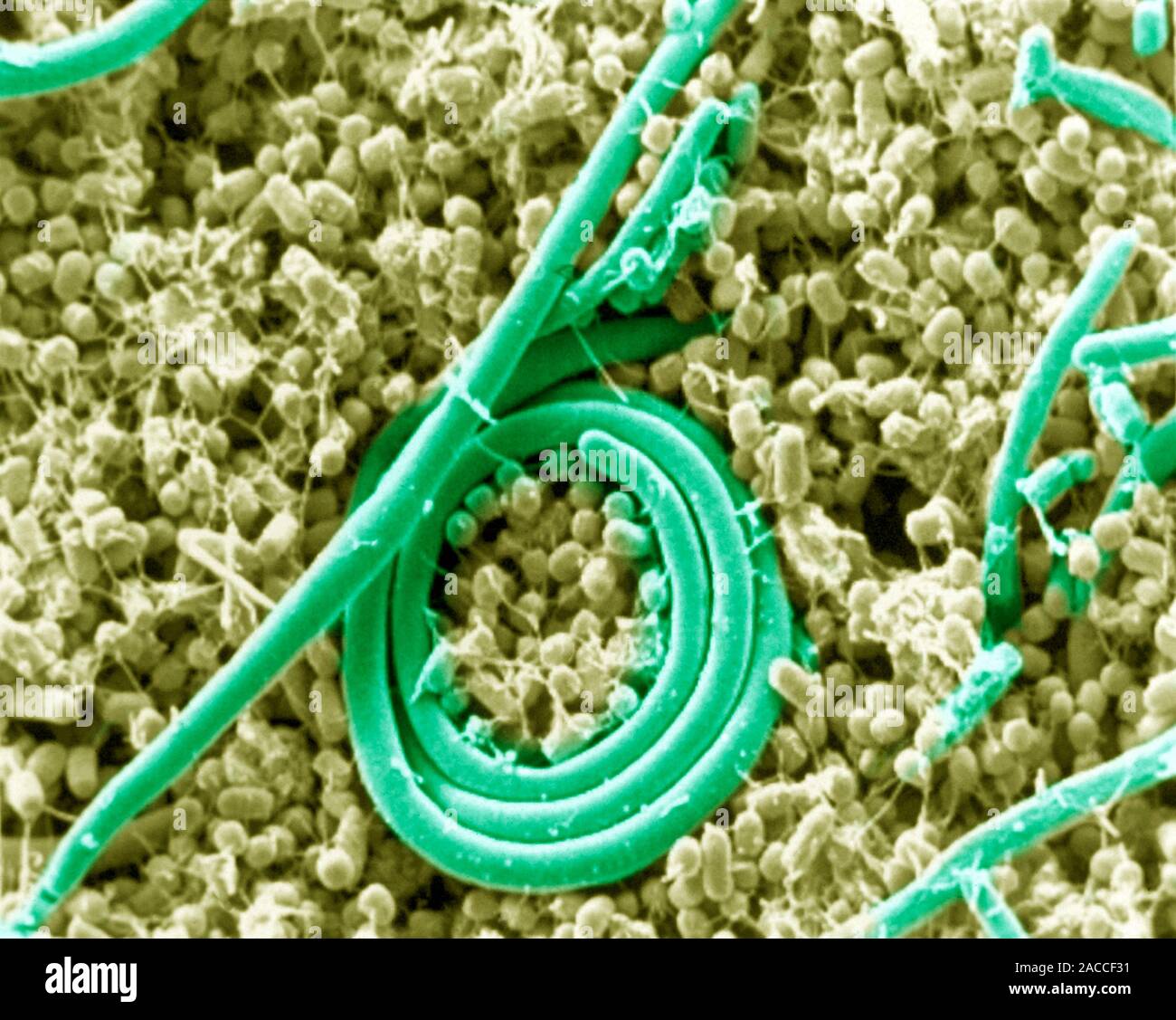 Salmonella enteritidis bacteria. Scanning electron micrograph (SEM ...