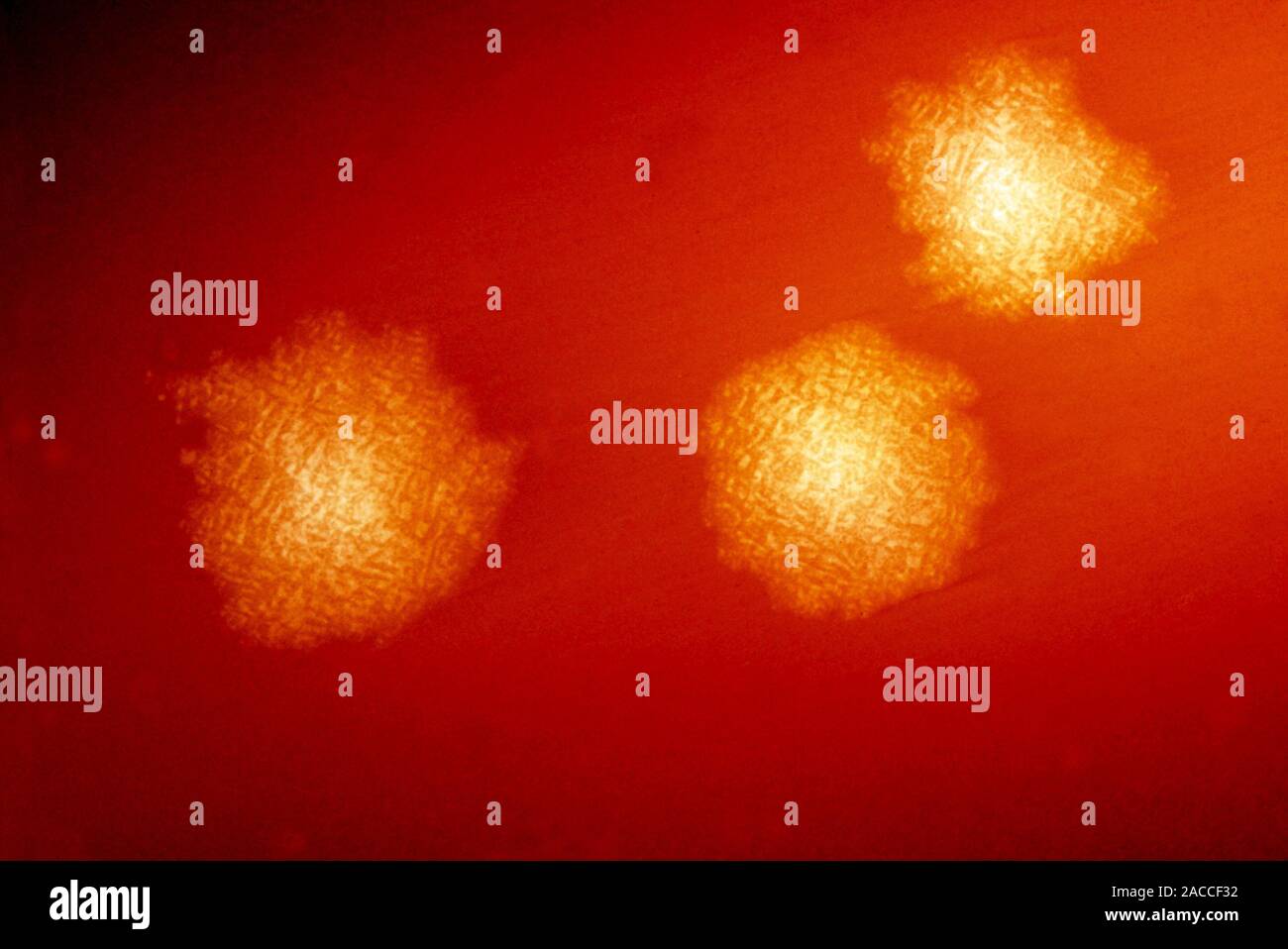 Clostridium difficile bacteria. Colonies of C. difficile bacteria after ...