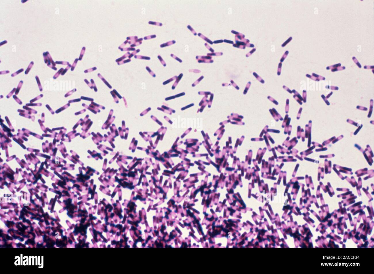 Clostridium Difficile Gram Stain