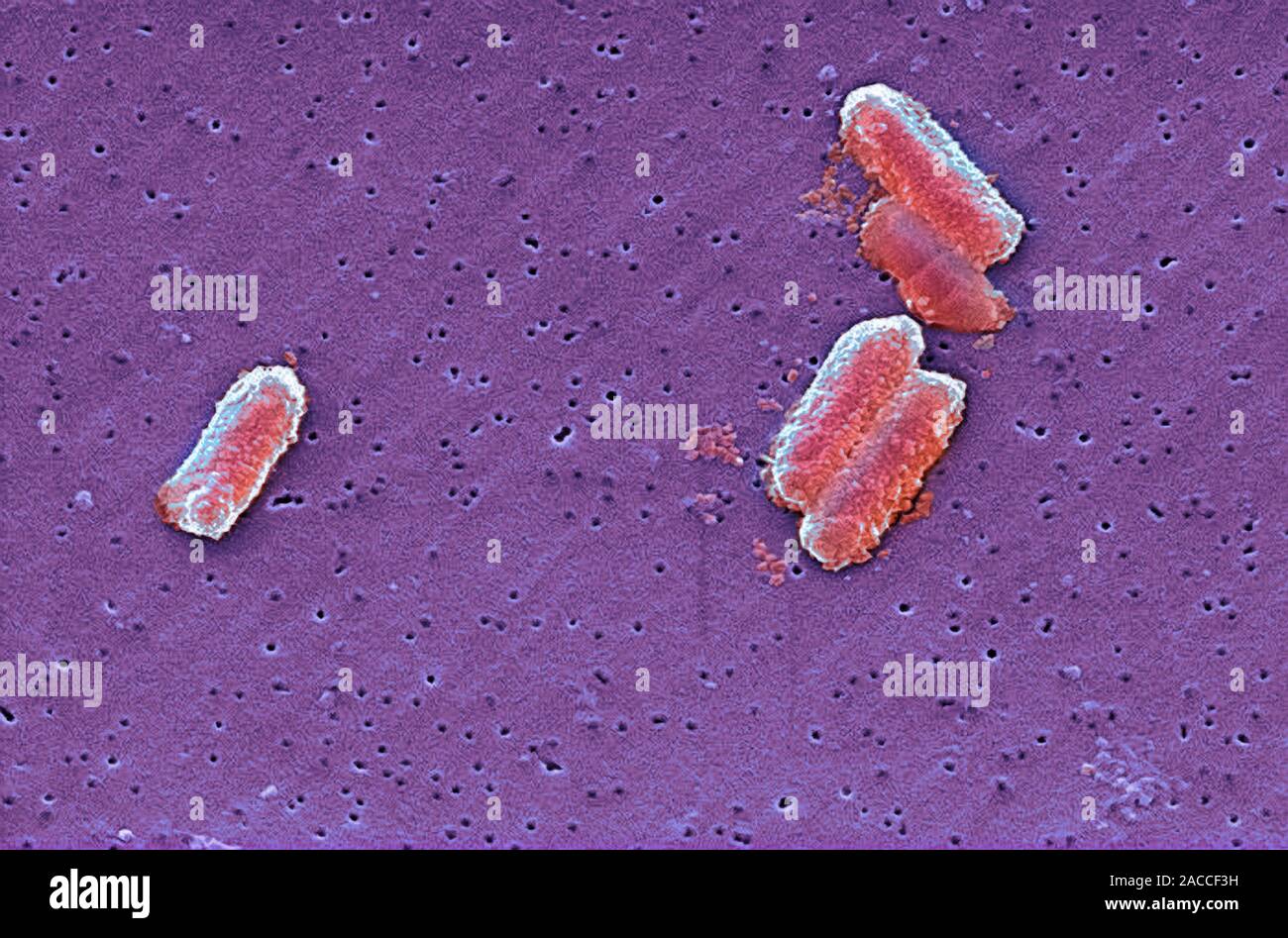Citrobacter bacteria. Coloured scanning electron micrograph (SEM) of ...