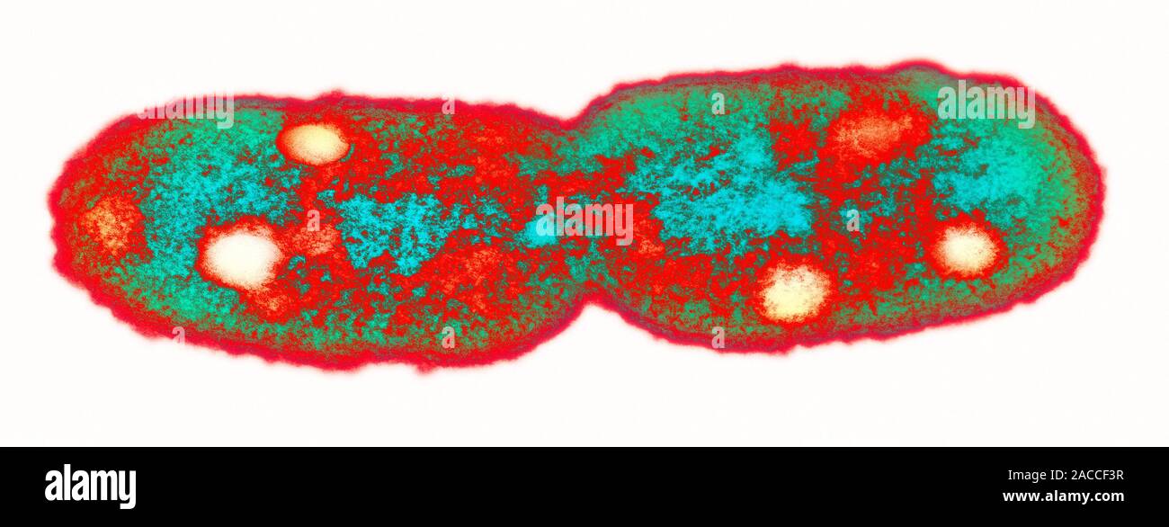 Mycobacterium dividing. Coloured transmission electron micrograph (TEM ... Mycobacterium dividing. Coloured transmission electron micrograph (TEM ...