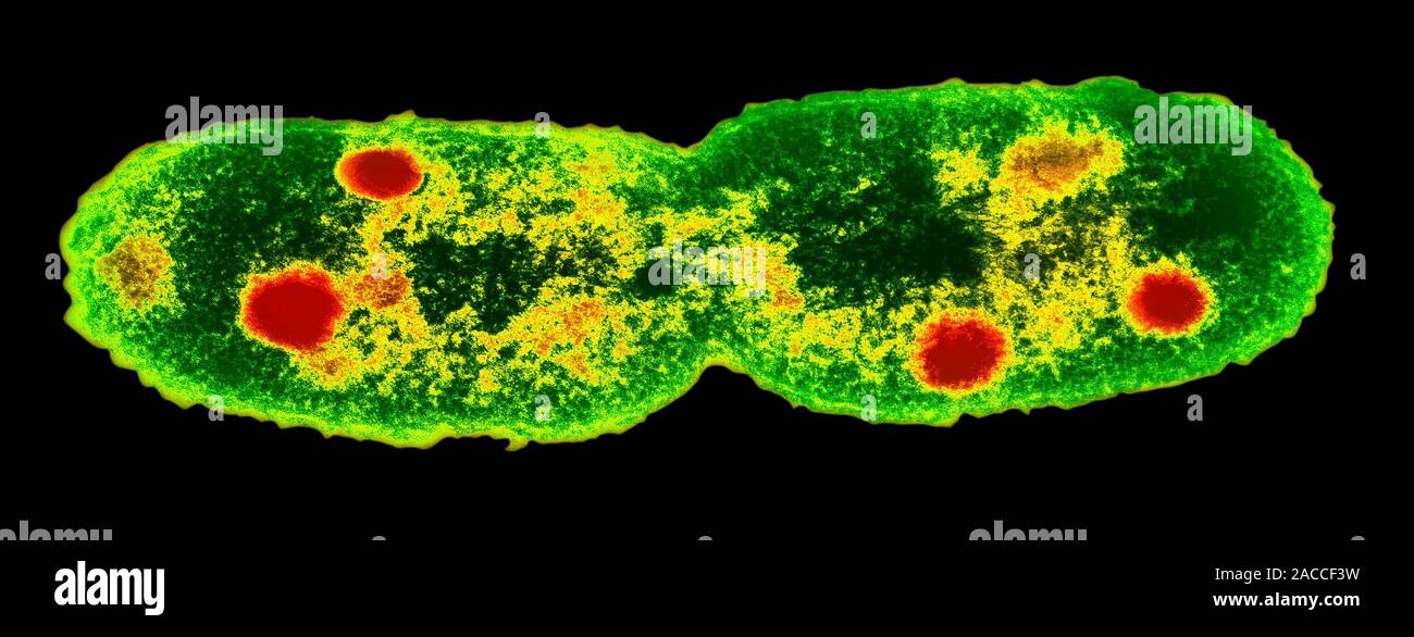 Mycobacterium dividing. Coloured transmission electron micrograph (TEM ... Mycobacterium dividing. Coloured transmission electron micrograph (TEM ...