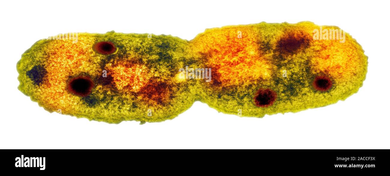 Mycobacterium dividing. Coloured transmission electron micrograph (TEM ... Mycobacterium dividing. Coloured transmission electron micrograph (TEM ...