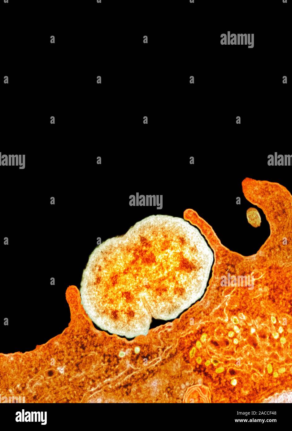 Gonorrhoea bacteria. Coloured transmission electron micrograph (TEM) of ...