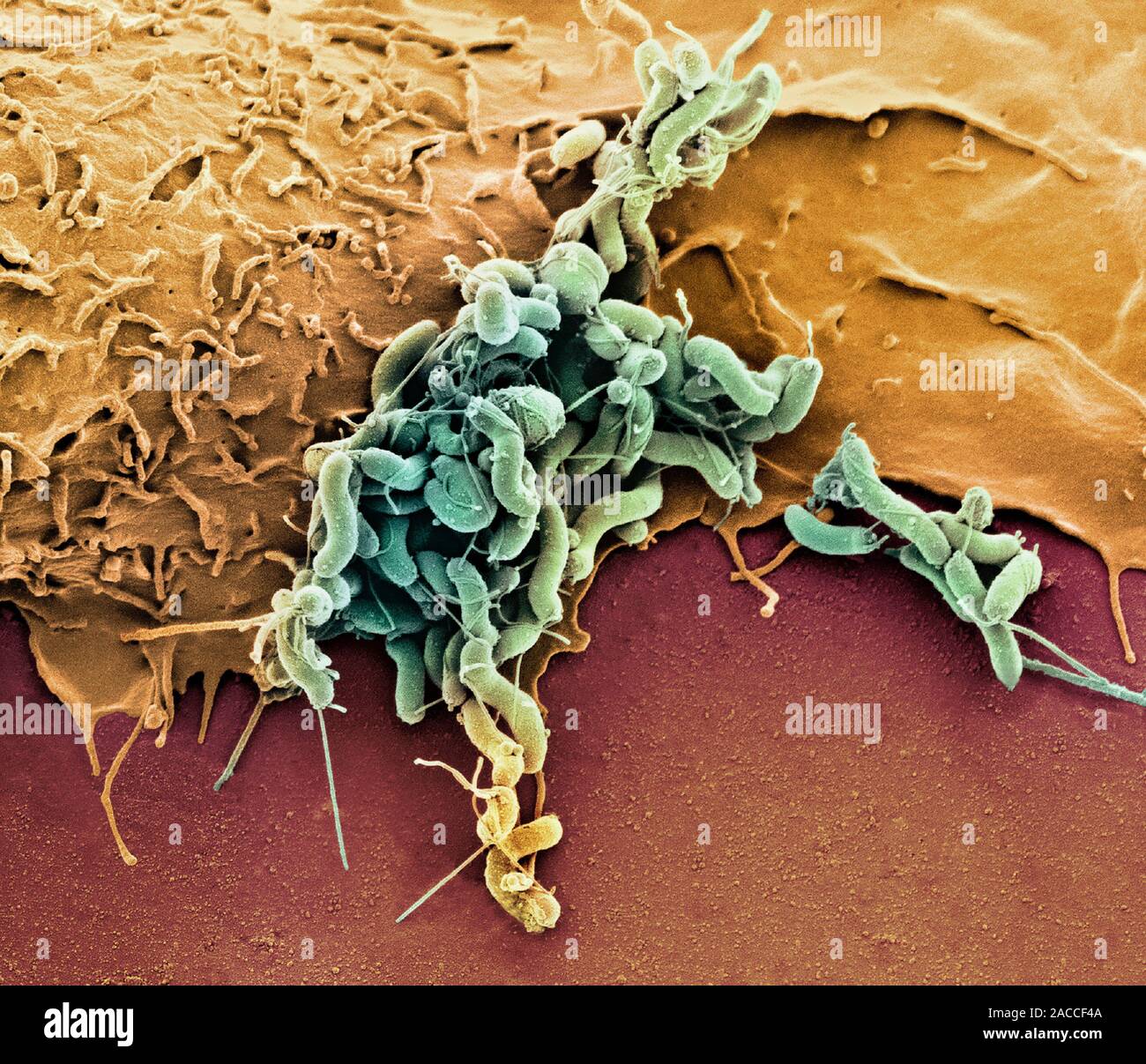 Helicobacter pylori bacteria. Coloured scanning electron micrograph (SEM) of H. pylori bacteria ...