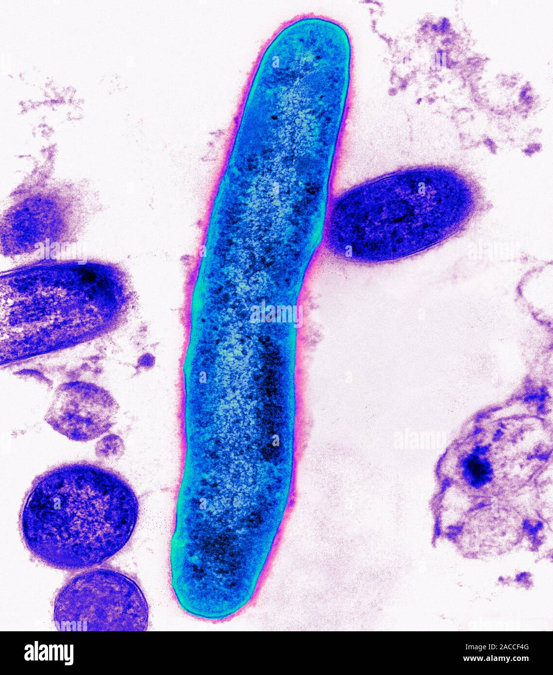 Mycobacterium bacteria. Coloured transmission electron micrograph (TEM ...