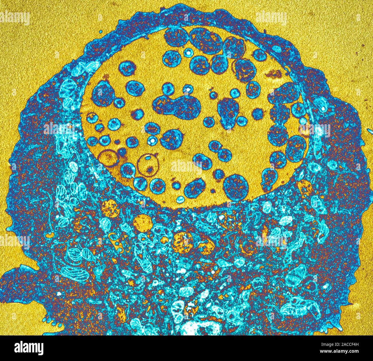 Chlamydia bacteria. Coloured transmission electron micrograph (TEM) of ...