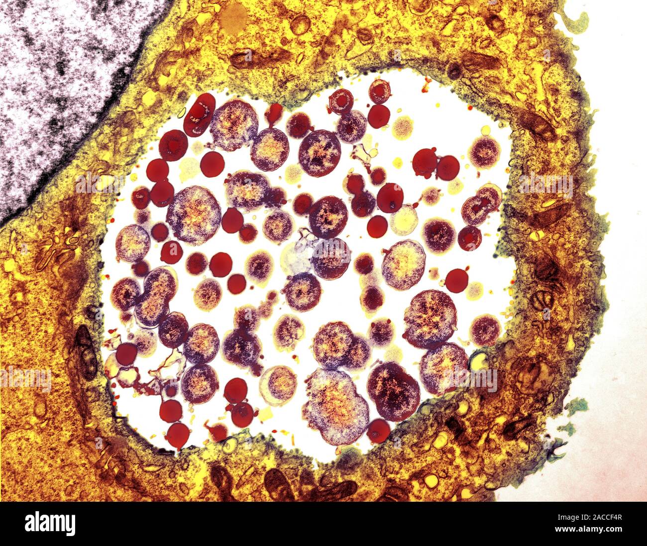 Chlamydia trachomatis bacteria, TEM. Coloured transmission electron ...