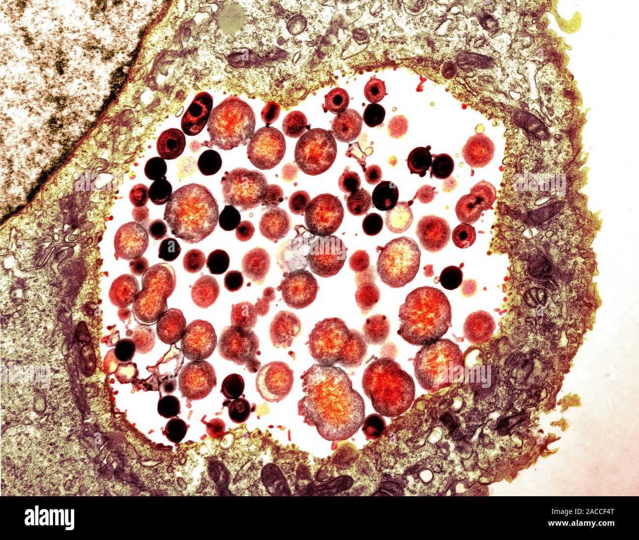 Chlamydia trachomatis bacteria, TEM. Coloured transmission electron ...