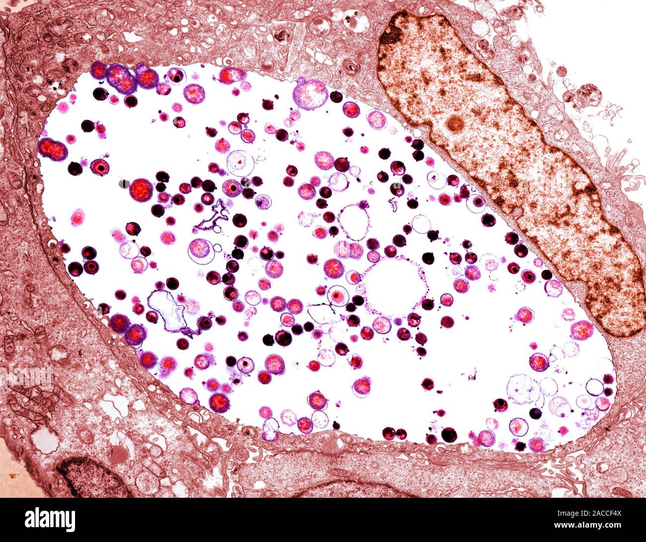Chlamydia trachomatis bacteria, TEM. Coloured transmission electron ...
