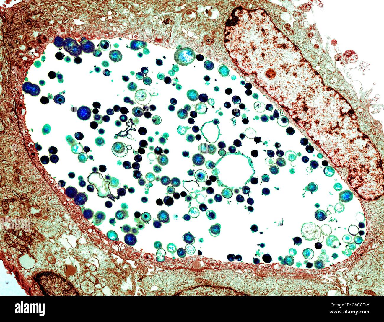 Chlamydia trachomatis bacteria, TEM. Coloured transmission electron ...